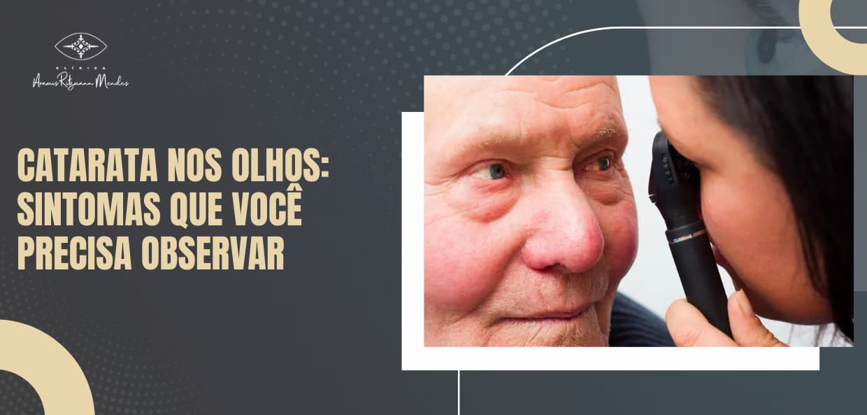 Catarata nos Olhos: Sintomas que Você Precisa Observar